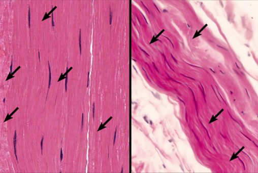 Slide 9 – Connective Tissues – BIOL 1594 Lab Review
